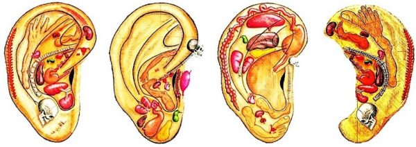 Daith Piercing » Battlefield Acupuncture Seminars | Battlefield ...